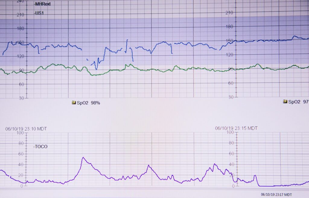 Fetal Monitoring: Why It’s Crucial During Pregnancy and Labor - Hoffer ...